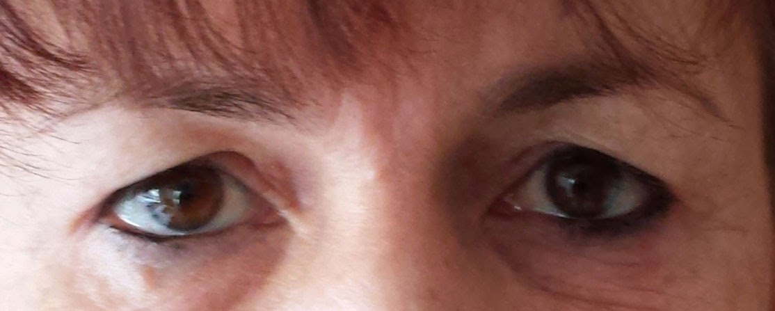 Claudias-Augenblick: Offene Augen, ein langer Wunsch geht in Erfüllung.