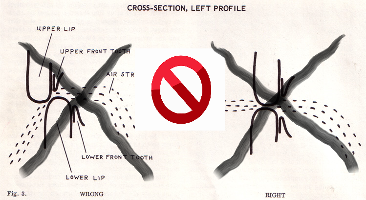 Living with Embouchure Dystonia: Rehabilitation Methods for Embouchure ...