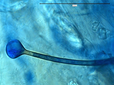 Fun With Microbiology (What's Buggin' You?): Apophysomyces elegans ...