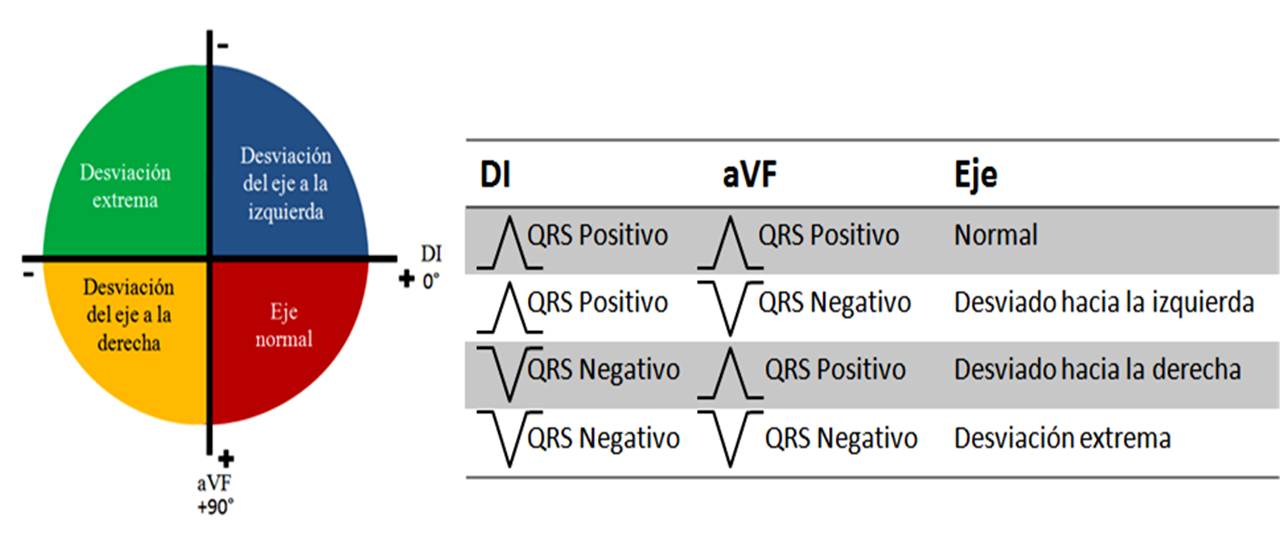 Tutomedic: RUTINA DE INTERPRETACIÓN DEL ECG:3- Eje de QRS