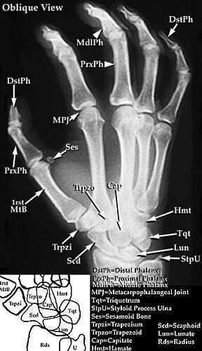Assalamu Alaikum...: TEKNIK RADIOGRAFI EKSTREMITAS SUPERIOR
