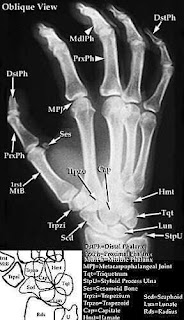 Assalamu Alaikum...: TEKNIK RADIOGRAFI EKSTREMITAS SUPERIOR