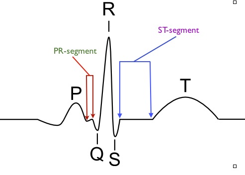 Learning how to read electrocardiograms (EKGs): How do they measure?