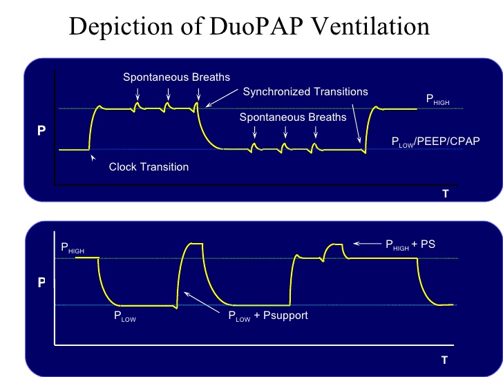 Class learning in Ventilator mode
