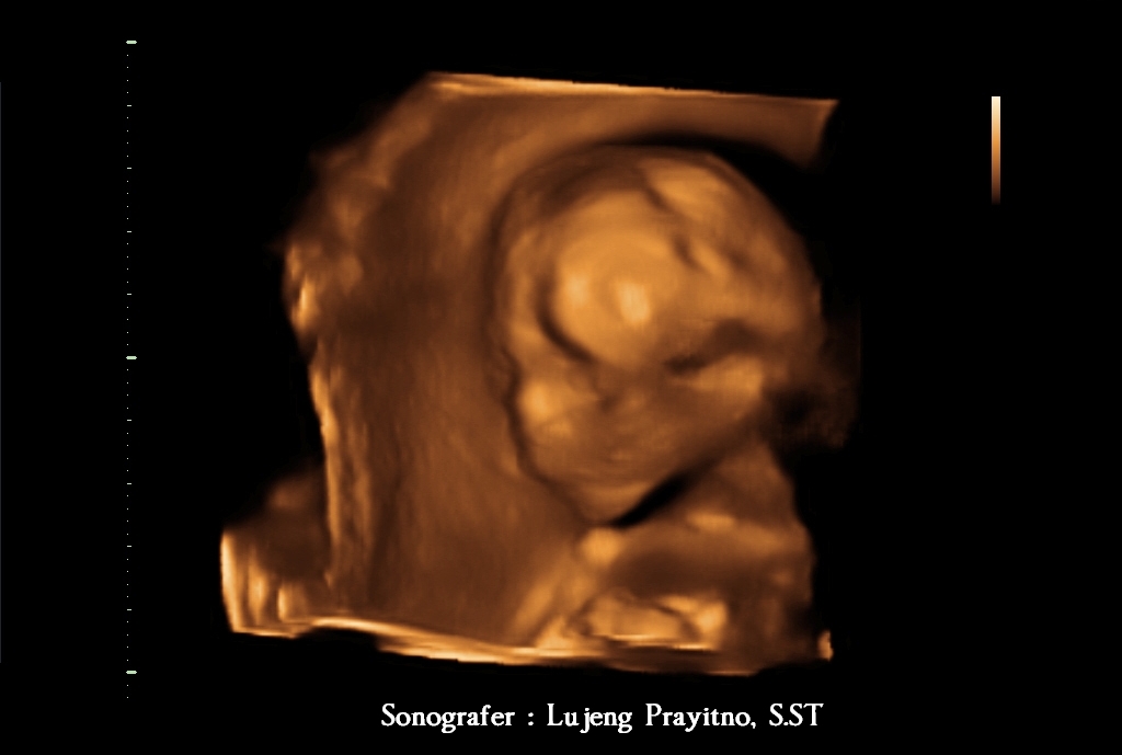 Teknik USG 4 Dimensi