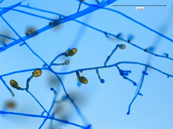 Fun With Microbiology (What's Buggin' You?): Stemphylium species