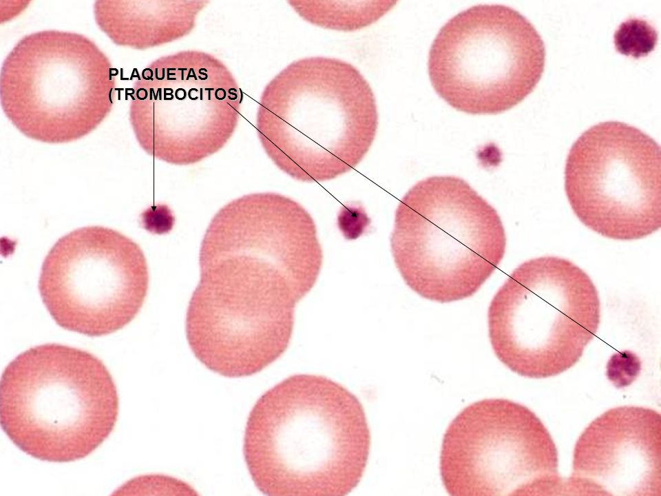 Células Sanguíneas: Plaquetas/Trombocitos