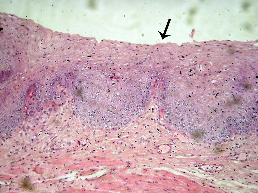 Histologia UFJF: Lâmina 5 - Esôfago