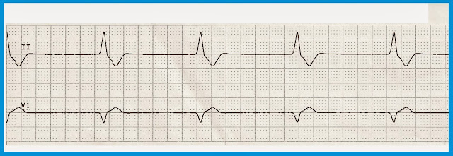 Practice EKG Rhythm Strips 219