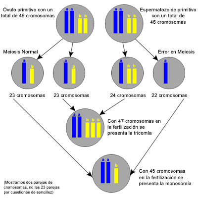 Trisonomía del cromosoma 21 : Trisonomía del Cromosoma 21