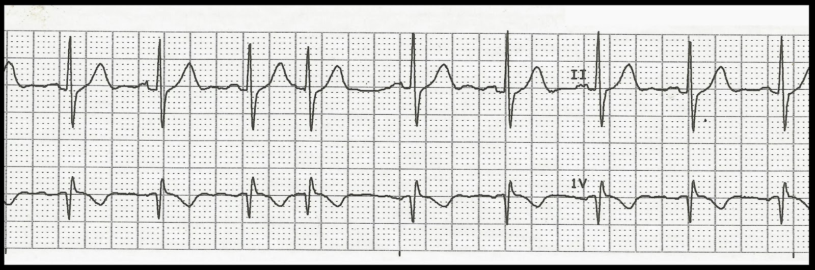 EKG Rhythm Strip Quiz 182