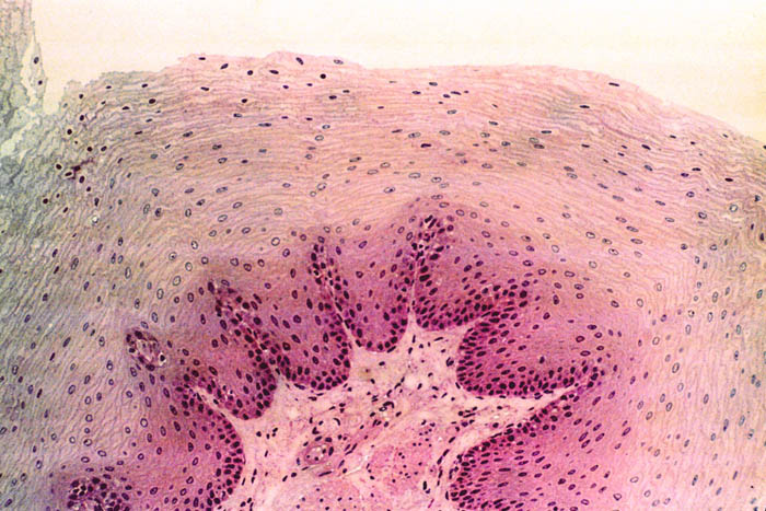 Physiology & Anatomy: Six Epithelia Tissues