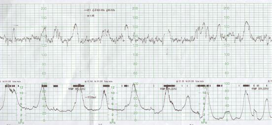 Christophe et Barbara sont très très loin