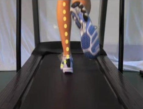 Fisioterapia - Denise Pripas: Teste da pisada