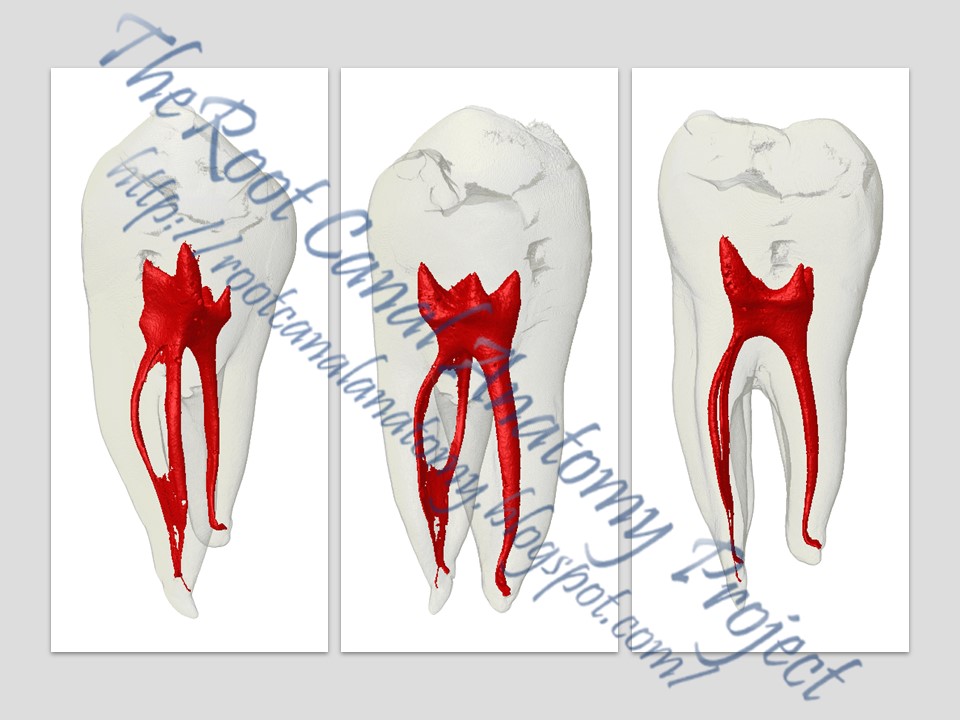 The Root Canal Anatomy Project