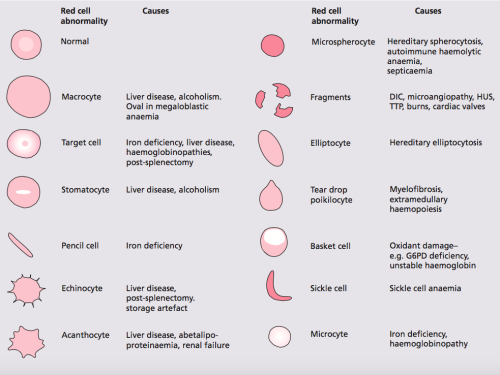 Poikilocytosis - Definition, Symptoms, Causes, Types, Treatment ...