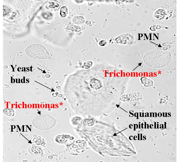 Medical Outlines: Trichomonas