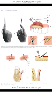 FUNDAMENTOS DE ANESTESIA Y EXODONCIA : INCISIONES Y SUTURAS