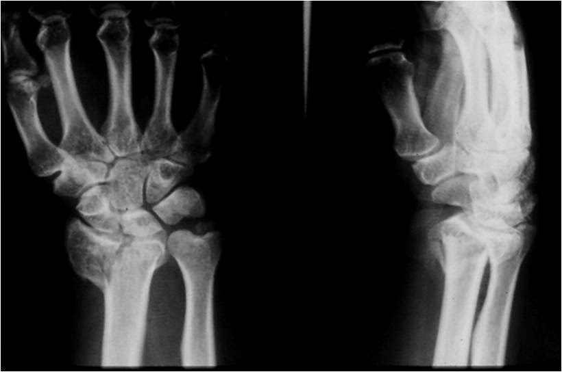 FERN Usosy aplicaciones: 13.b.- Aplicaciones