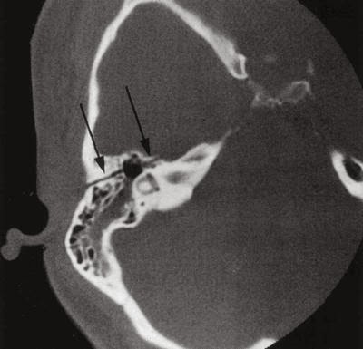 Daily Dose ENT: 2013