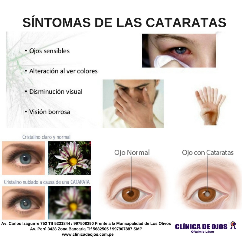 Clínica de Ojos Oftalmic Láser: Síntomas de las cataratas