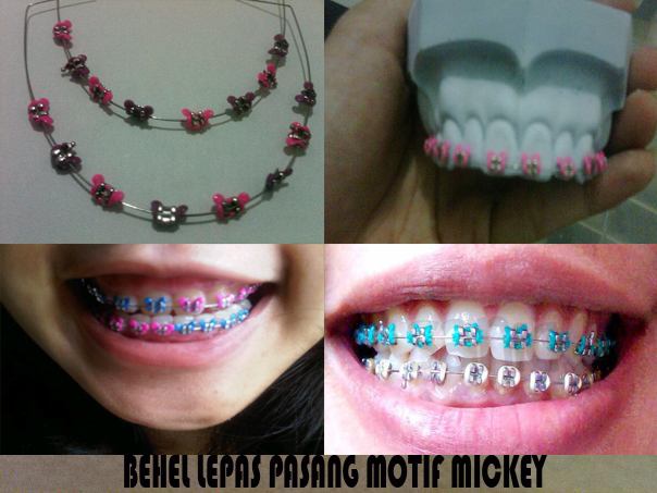 @GAYAOLSHOP: ♥ BEHEL LEPAS PASANG