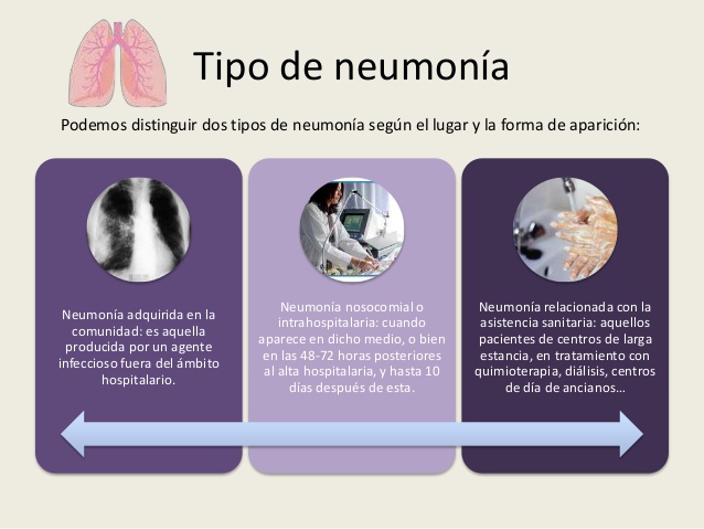 neumonia