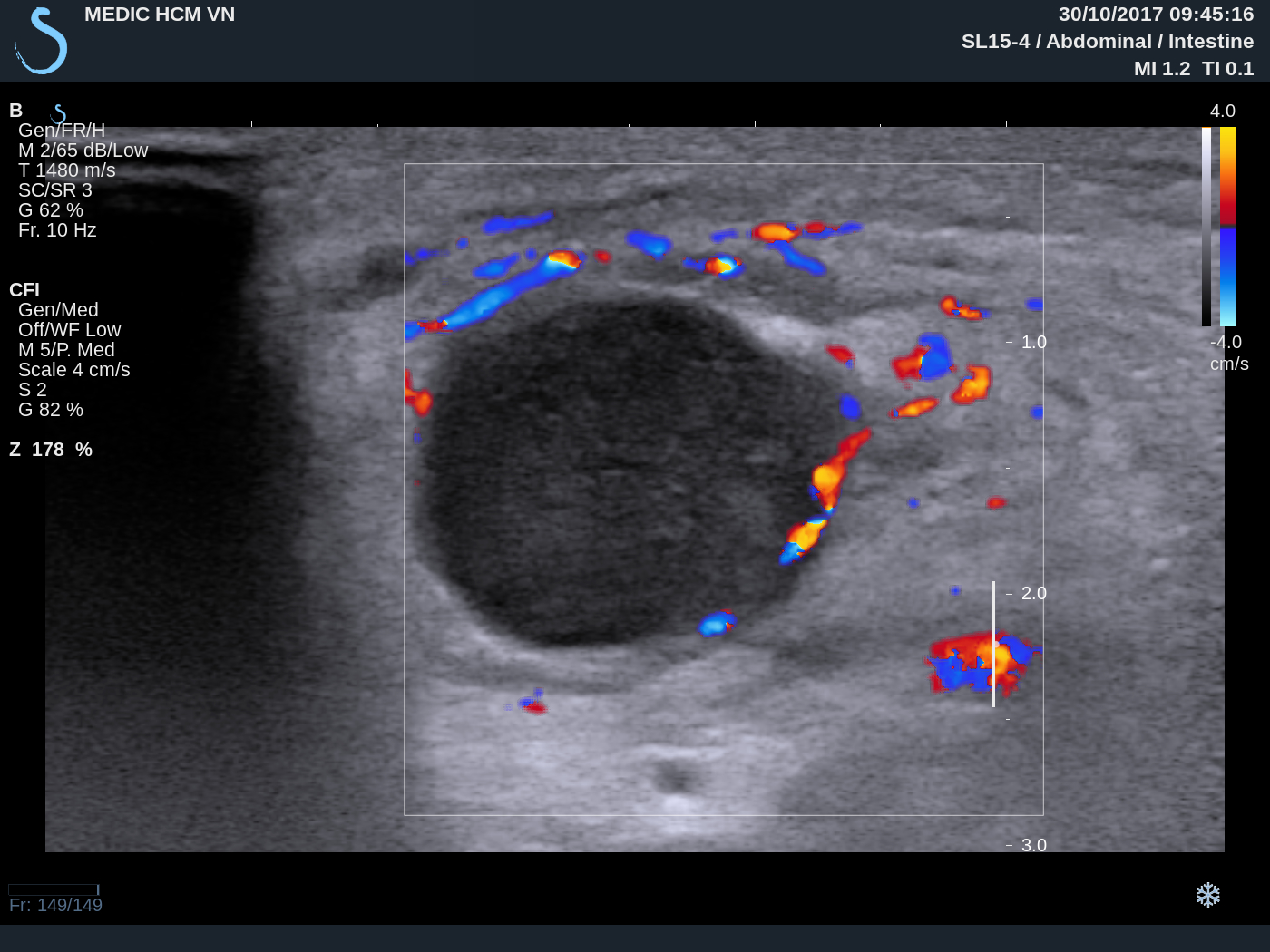 VIETNAMESE MEDIC ULTRASOUND: CASE 459 : CERVICAL LYMPH NODES, Dr PHAN ...
