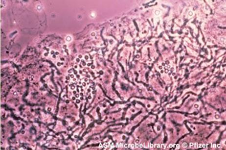 Malassezia Yeast ~ My Story * ~: Malassezia Yeast: Samples ~ Viewed ...
