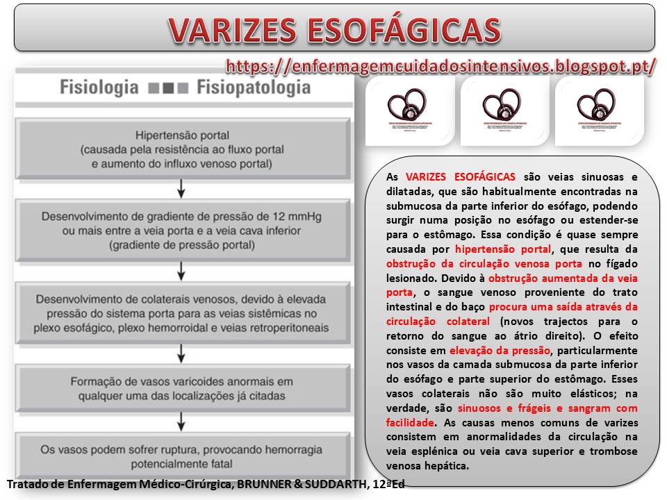 Viver Enfermagem em Cuidados Intensivos: VARIZES ESOFÁGICAS ...