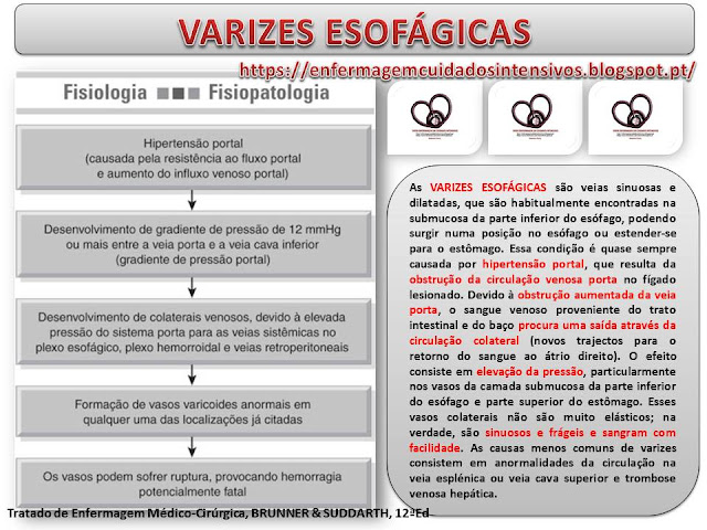 Viver Enfermagem em Cuidados Intensivos: VARIZES ESOFÁGICAS ...