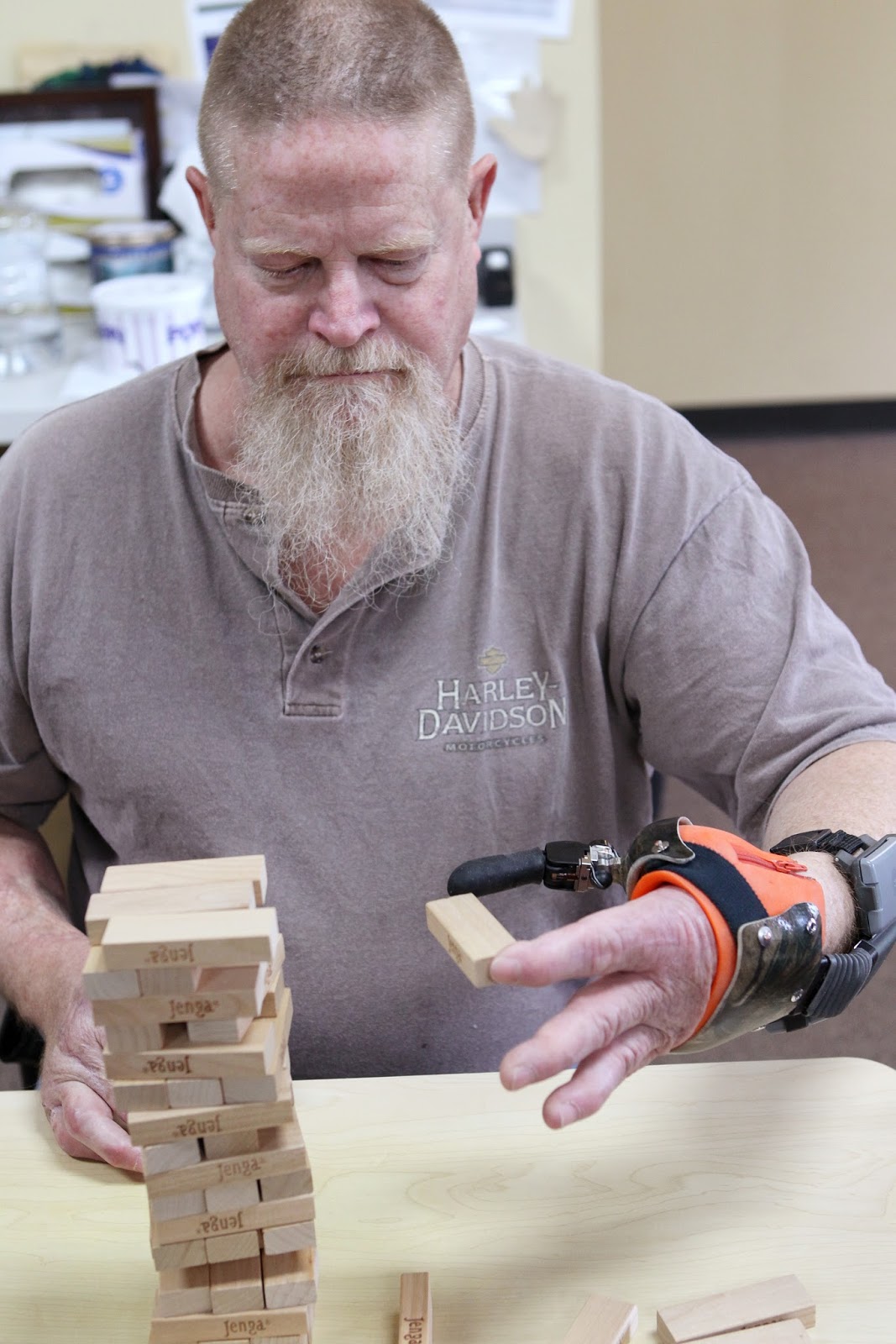 Mark Kodiak Ukena: Adam Pringle and his Bionic Thumb at Dynamic Hand ...