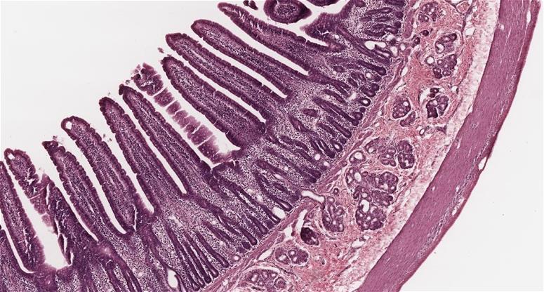 Sistem pencernaan, Usus halus, usus besar, dan Anus - Biologi Edukasi ...