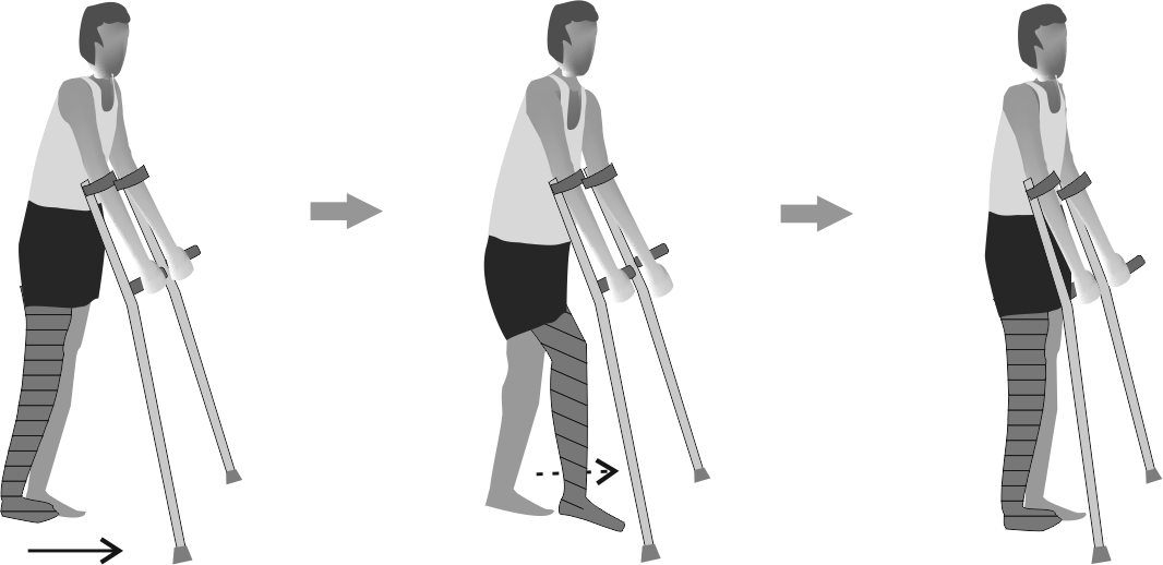 Tibia Fibula Fracture Rehab Protocol, physiotherapy Exercises