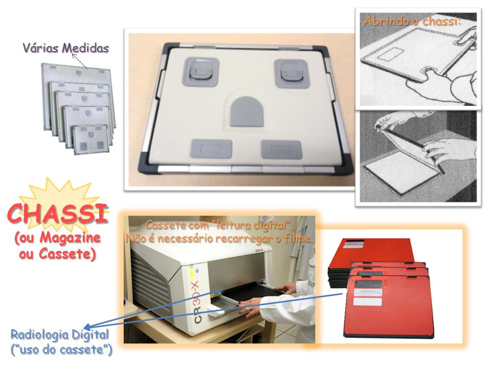 Aprendendo Radiologia: Equipamentos