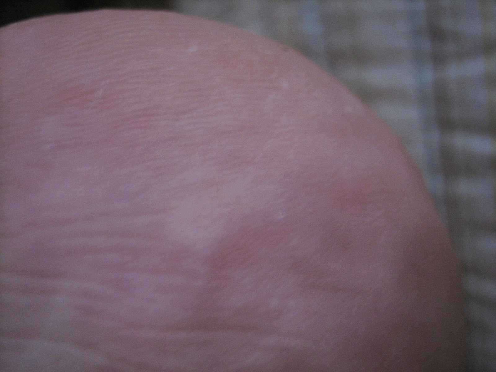 GFY Martha: The Truth about How to Fix Your Cracked Heels