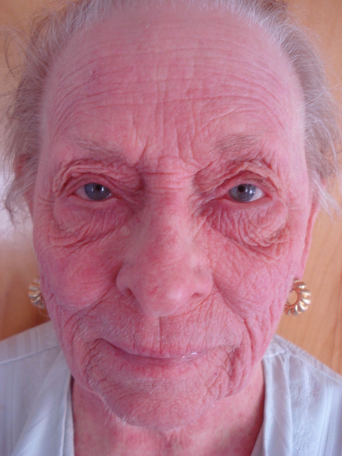 VIRTUAL GRAND ROUNDS IN DERMATOLOGY 2.0: September 2016