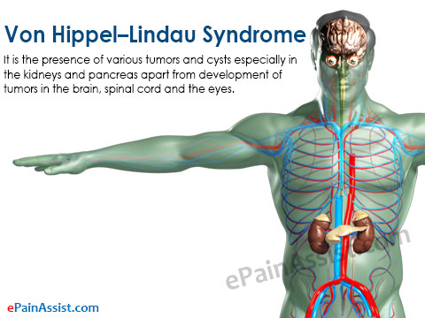 Deja Vu: 15 Absolutely Terrifying Diseases in the World!