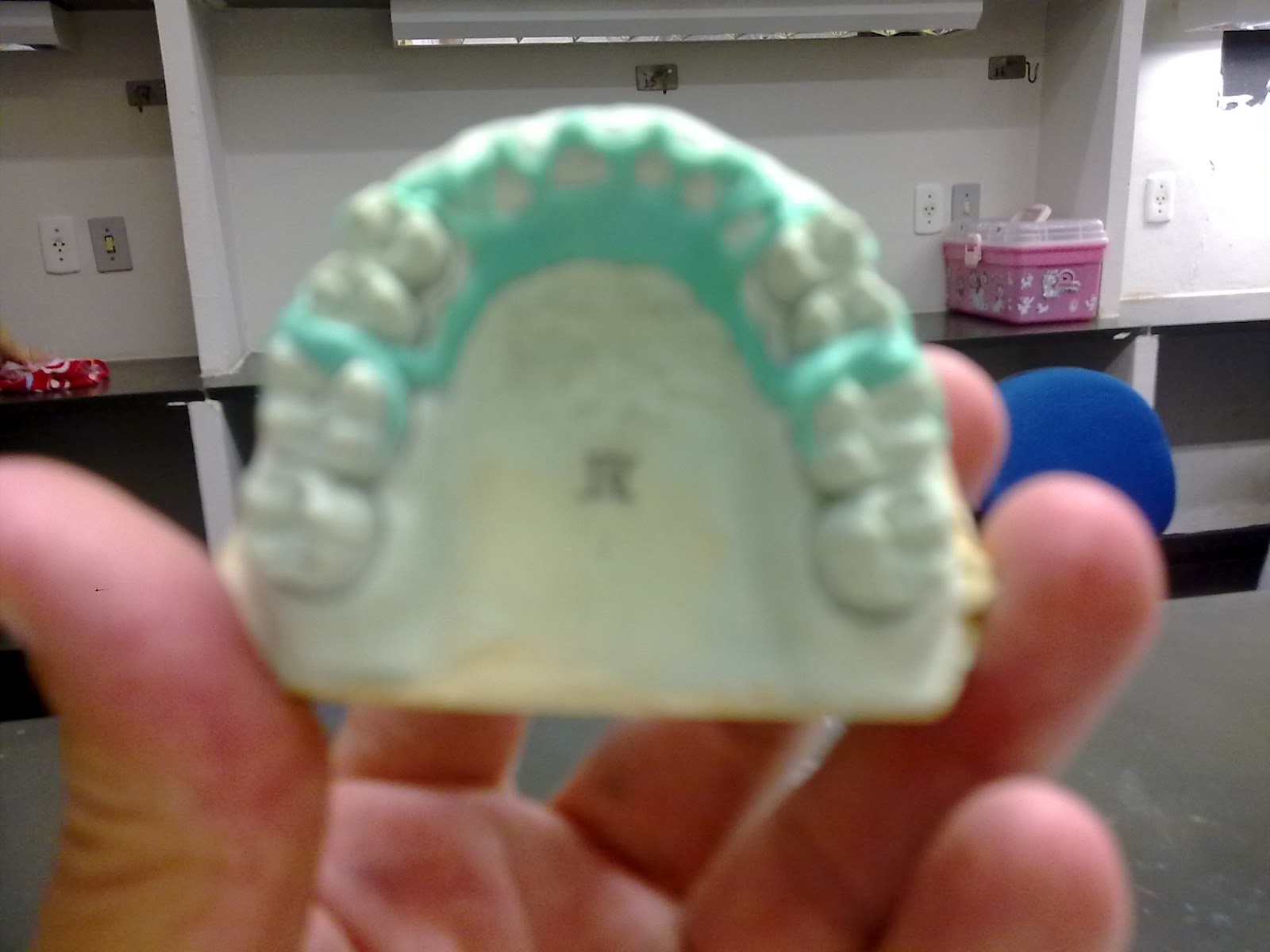 Protese Dentária: PPR - Algumas dicas para Avaliação Final - Profº ...