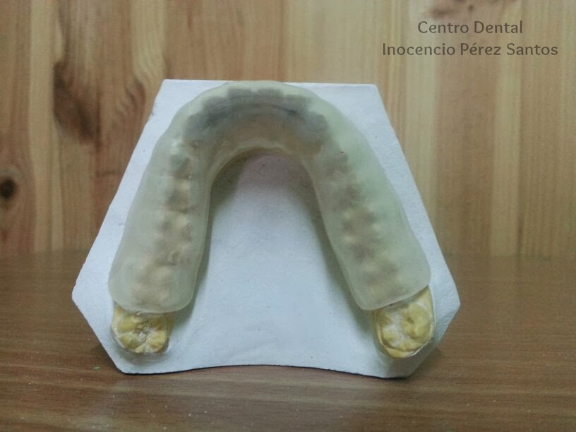 Prótesis dentales ~ Centro Dental Inocencio Perez Santos