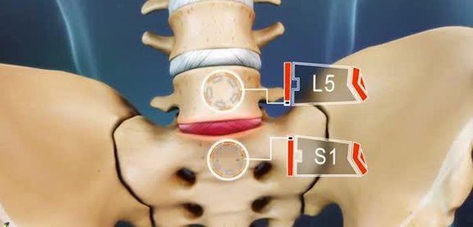 DESVENDANDO A COLUNA VERTEBRAL | Drª. Quéren - Clube dos parafusados