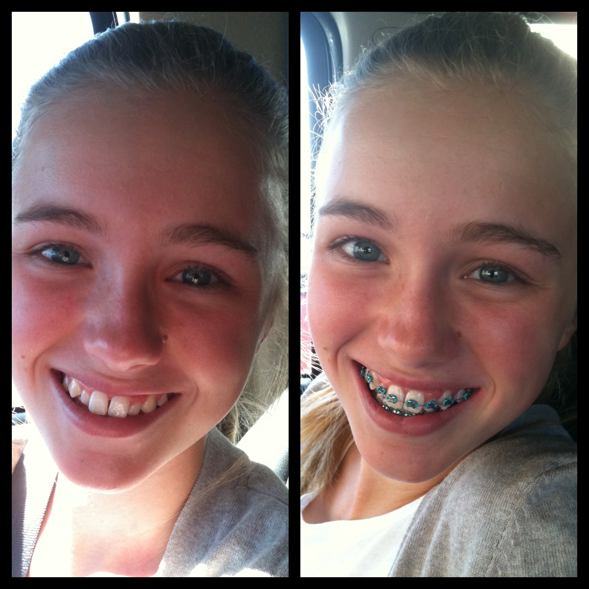 Brian Family: Last one in braces!