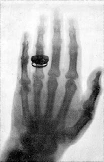 Hyder Ismail: A short History of X-rays
