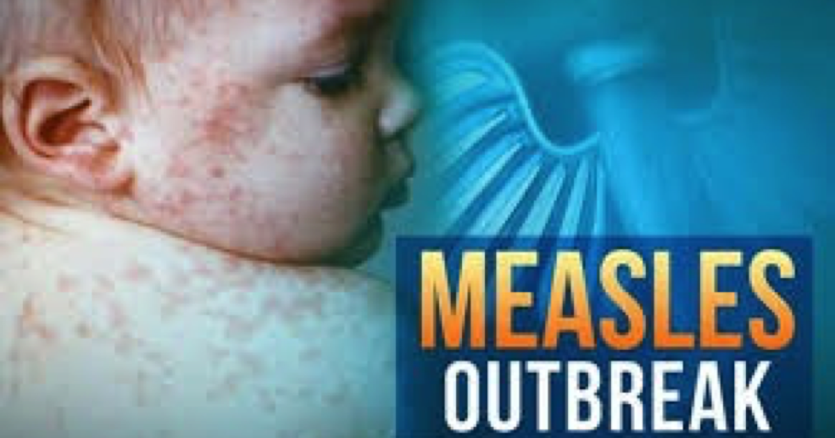 Public Linguist: Explaining Measles: Language Acting Badly