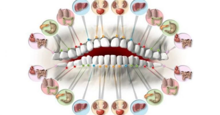 Every Tooth Is Linked To Internal Organs – Tooth Pain Describing The ...