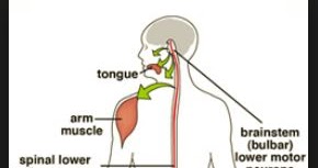 Living with Kennedy's Disease: Kennedy’s Disease and ALS