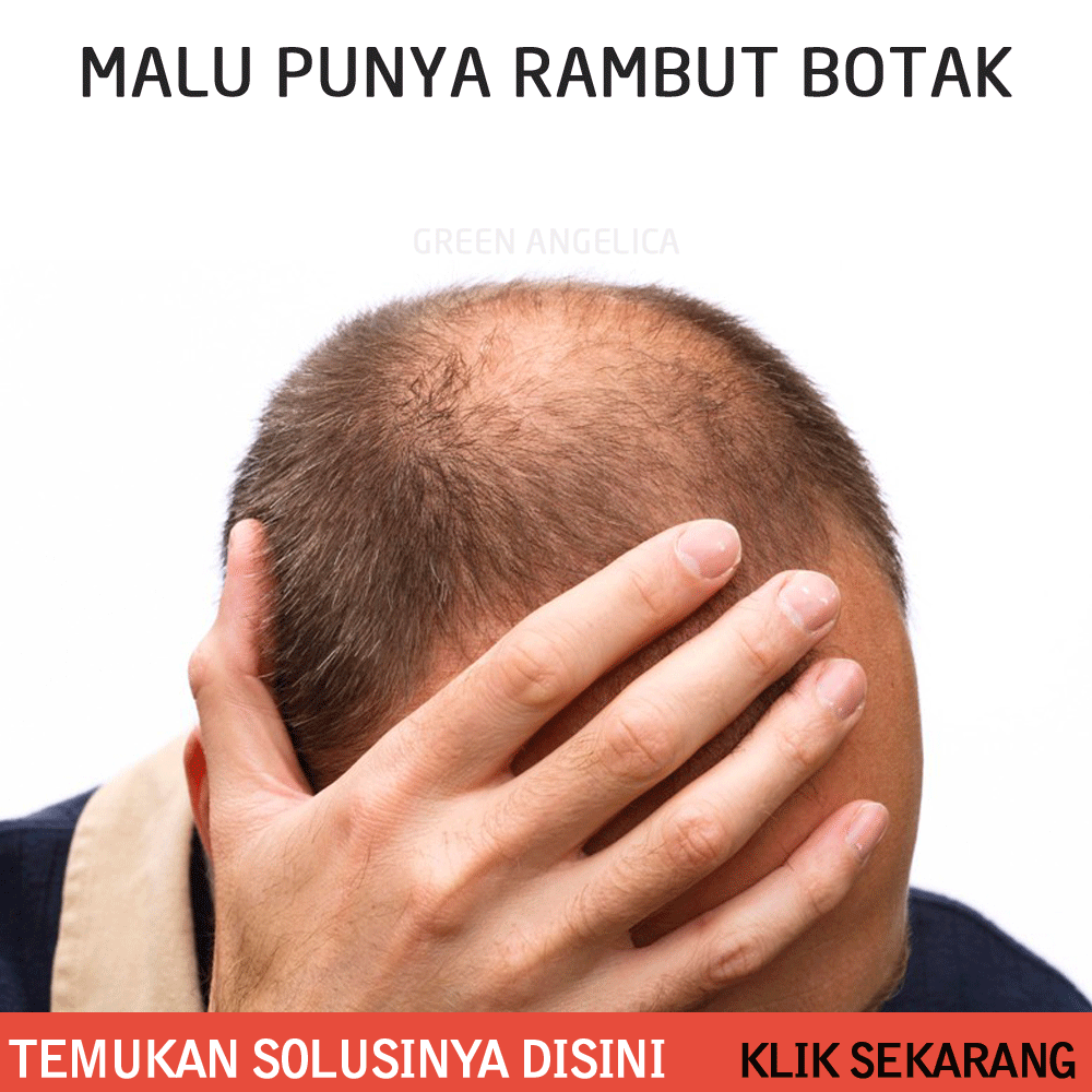 Penumbuh Rambut Botak Cepat Dan Alami - 085201042158 | Solusi Rambut ...