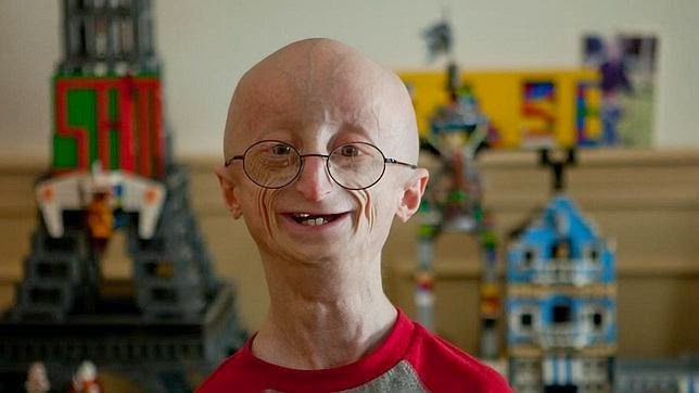 La enfermedad del niño: "La vida en un segundo"