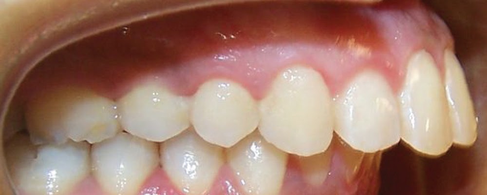 Plastic and Cosmetic Surgery: Correction of Dentofacial Deformities at ...