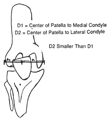 Fisioterapia em Traumato-Ortopedia Baseada em Evidências ...